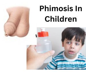 Phimosis Surgery Doctor In Pune | Pediatric Surgeon | Dr. Geeta